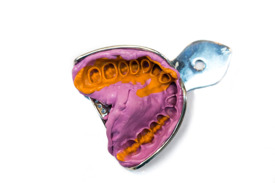 10 Tips para impresiones dentales perfectas - Odontomecum Blog