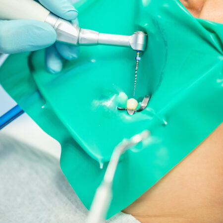 Conoce nuestra marca Endo ACCESS para dentistas - Odontomecum Blog